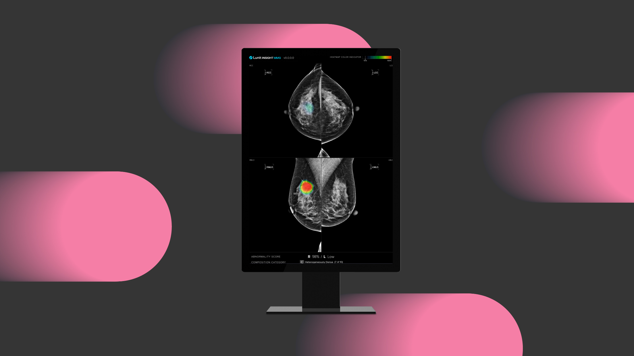 Lunits Ai Powered Mammography Analysis Solution Proves Comparable To
