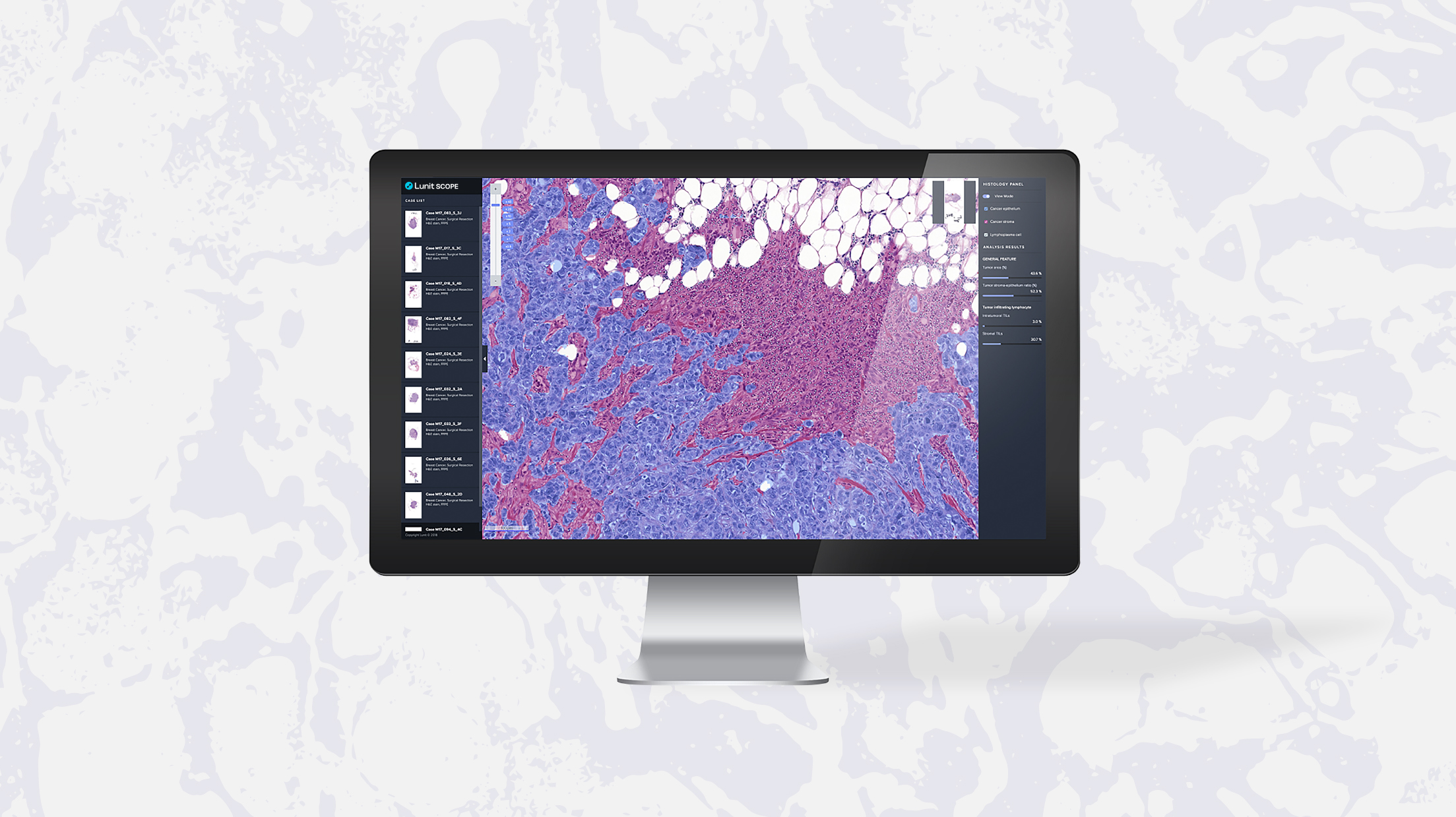 Lunit Highlights the Effectiveness of AI in Predicting Cancer Treatment Outcomes—Findings to be ...